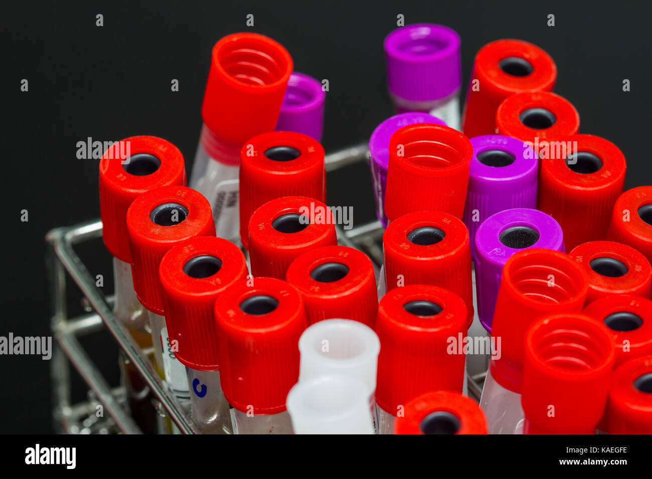 Closeup test tubes with blood for medical and biological analyzes ...