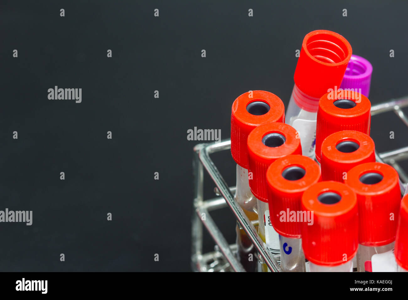 Closeup test tubes with blood for medical and biological analyzes ...