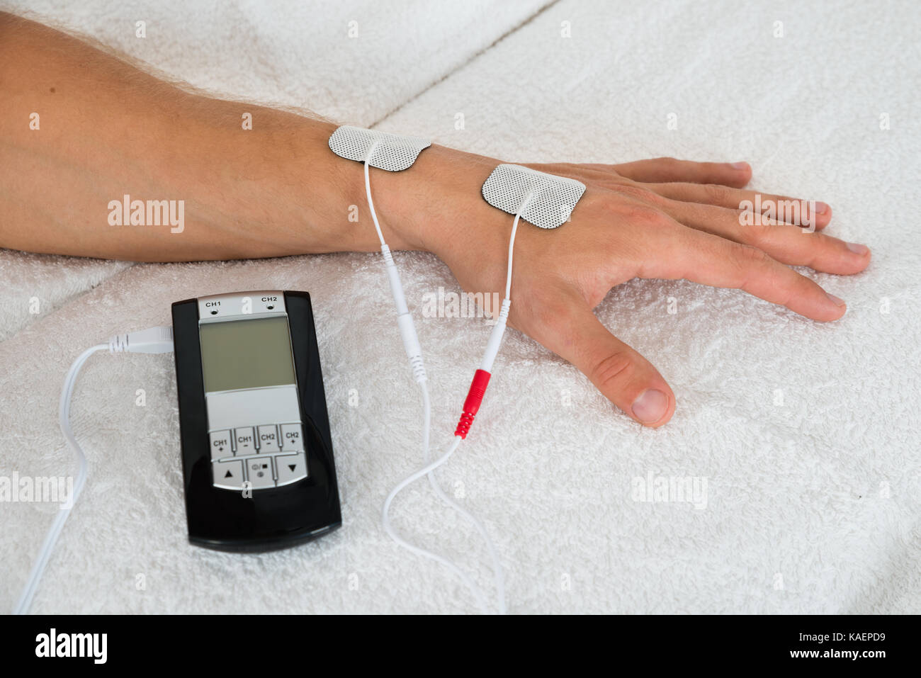 Electrode physiotherapy hi-res stock photography and images - Alamy