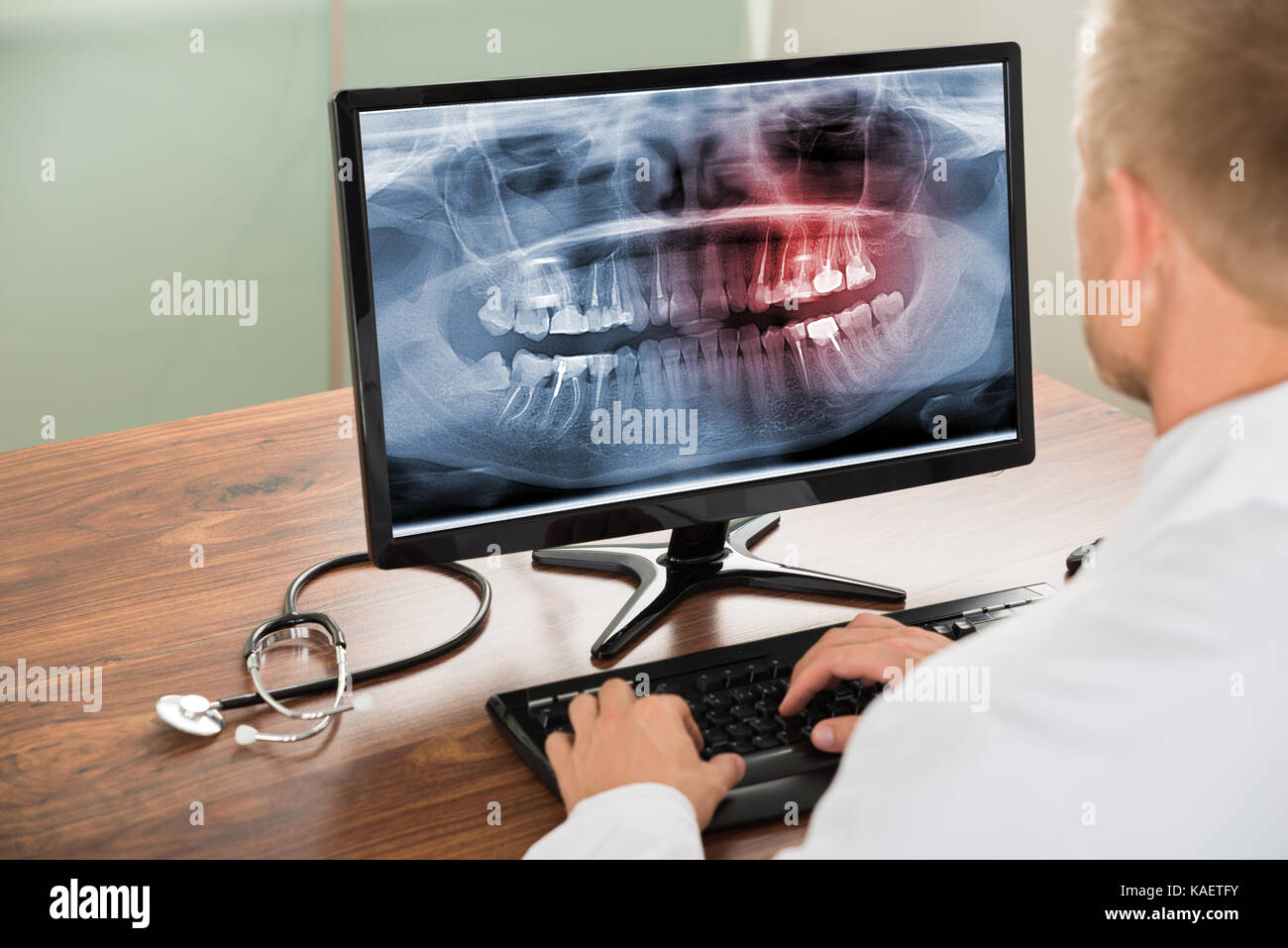 Close-up Of Male Doctor Looking At Teeth X-ray On Computer In Hospital ...