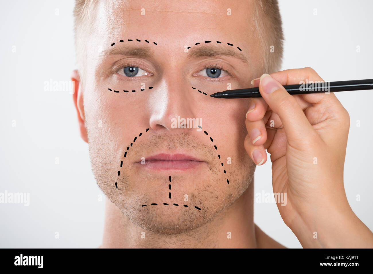 Man plastic surgery hi-res stock photography and images - Alamy