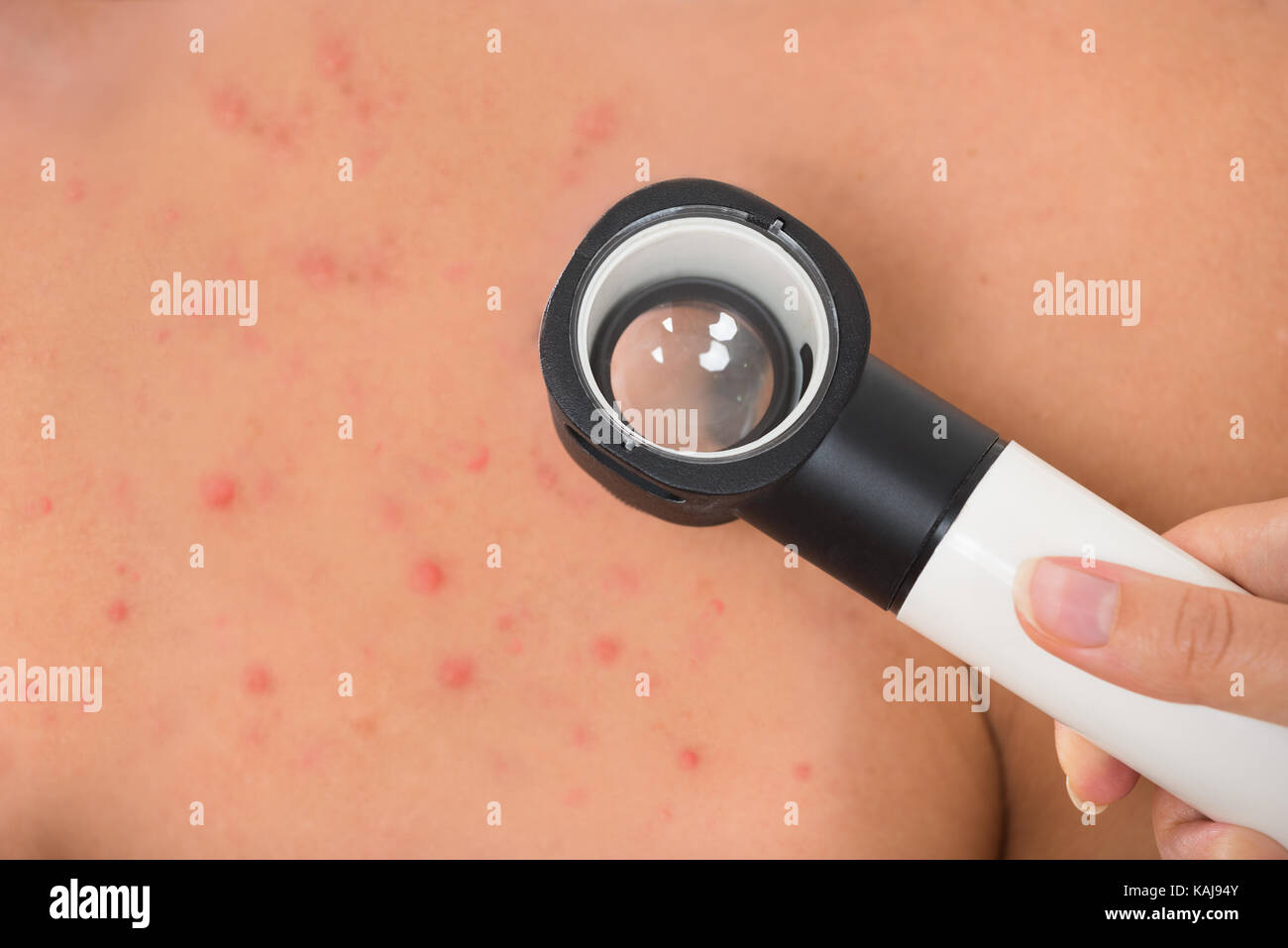 Skin test back of hand hi-res stock photography and images - Alamy