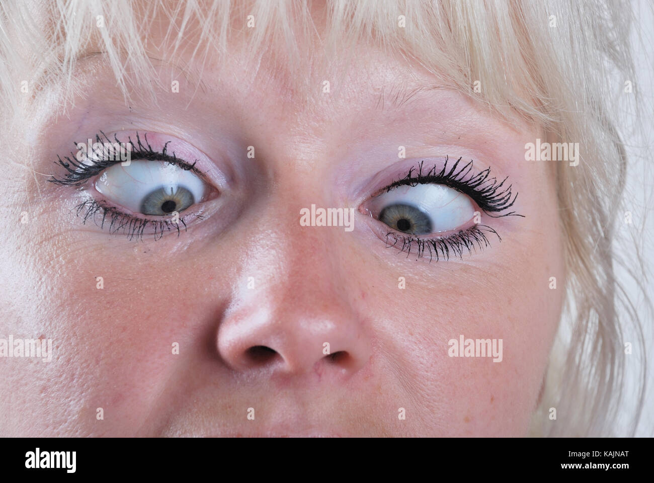 Squint Woman Eye High Resolution Stock Photography and Images - Alamy