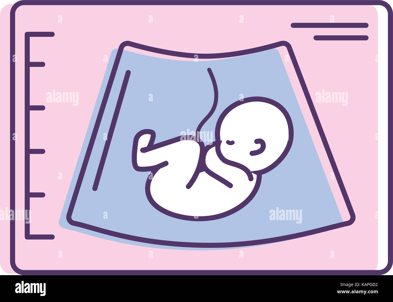 ultrasound of baby with umbilical cord Stock Vector Image & Art - Alamy