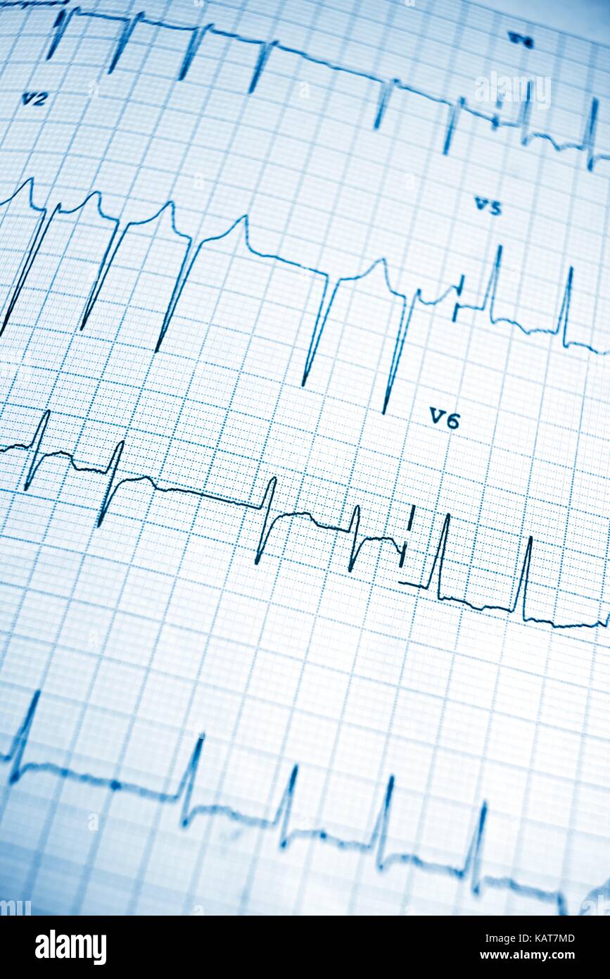 Close up of an electrocardiogram in paper form Stock Photo - Alamy