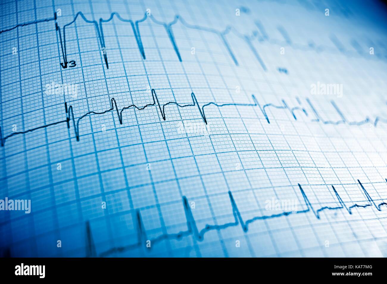 Close up of an electrocardiogram in paper form Stock Photo - Alamy