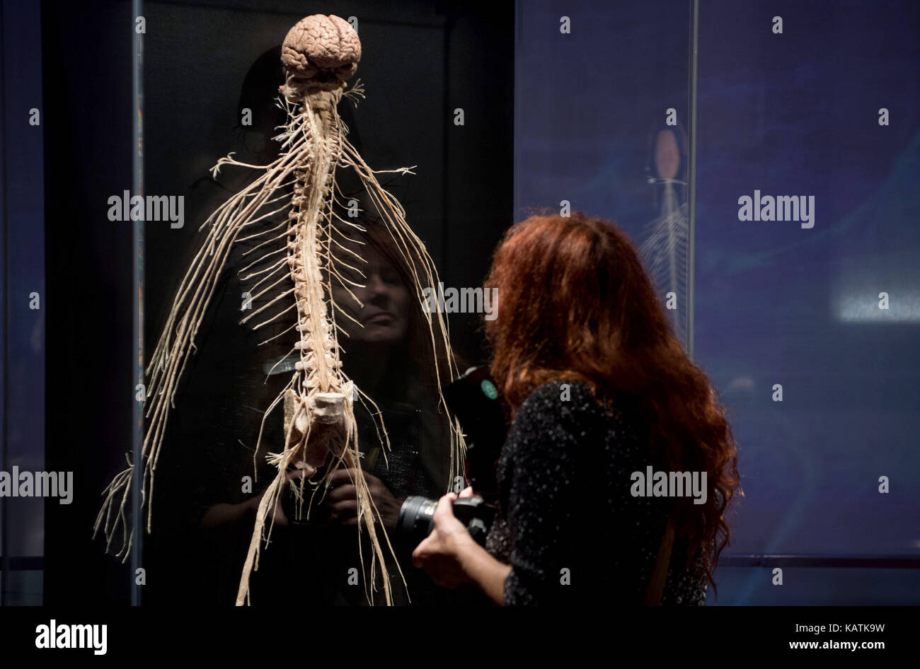 A full-body plastination of the nervous system in a new permanent ...