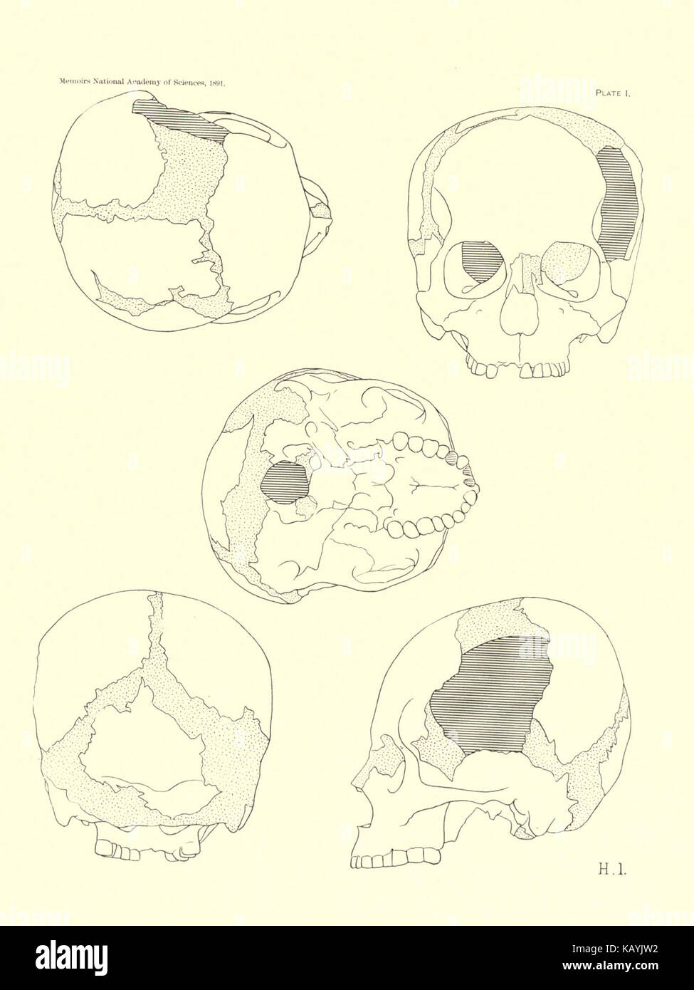 The human bones of the Hemenway collection in the United States Army ...