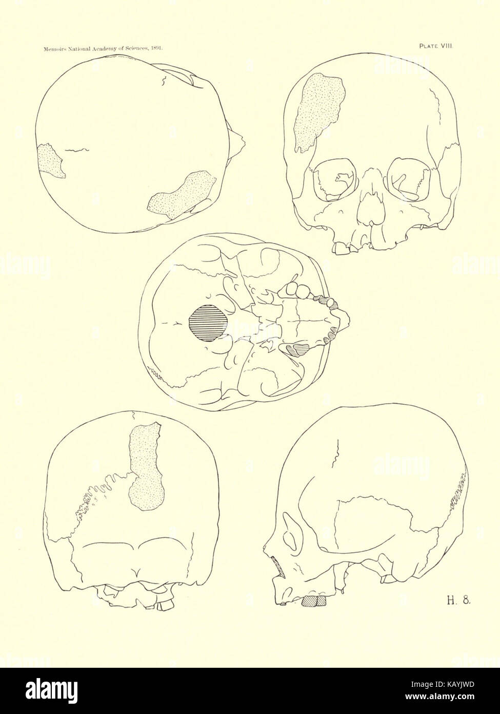 The human bones of the Hemenway collection in the United States Army ...
