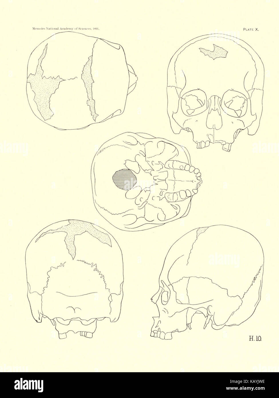 The human bones of the Hemenway collection in the United States Army ...