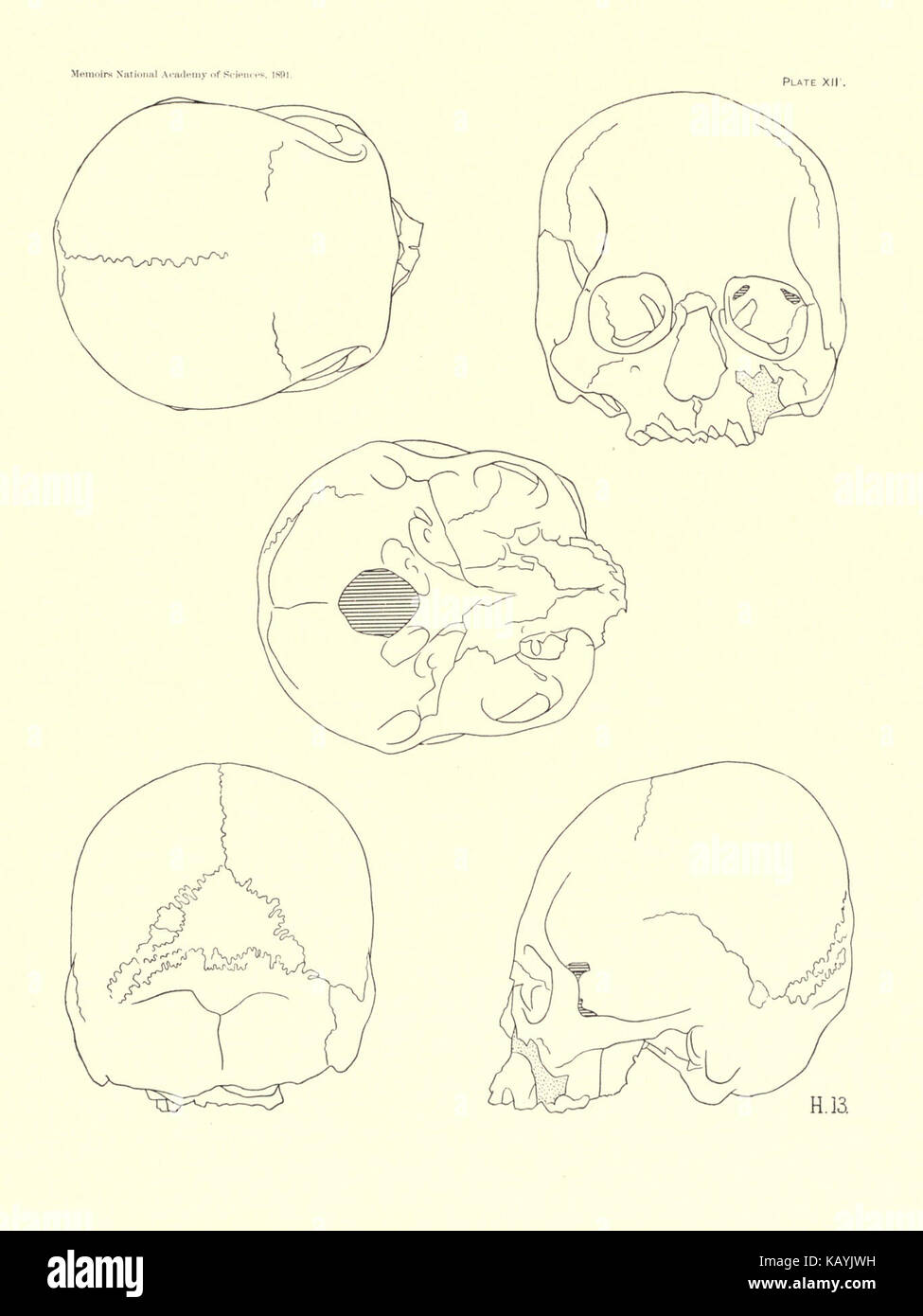 The human bones of the Hemenway collection in the United States Army ...