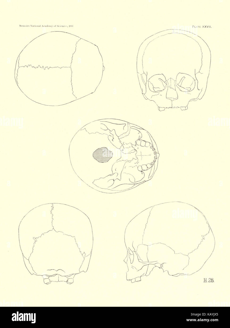 The human bones of the Hemenway collection in the United States Army ...