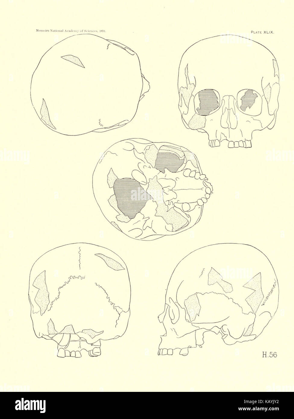 The human bones of the Hemenway collection in the United States Army ...