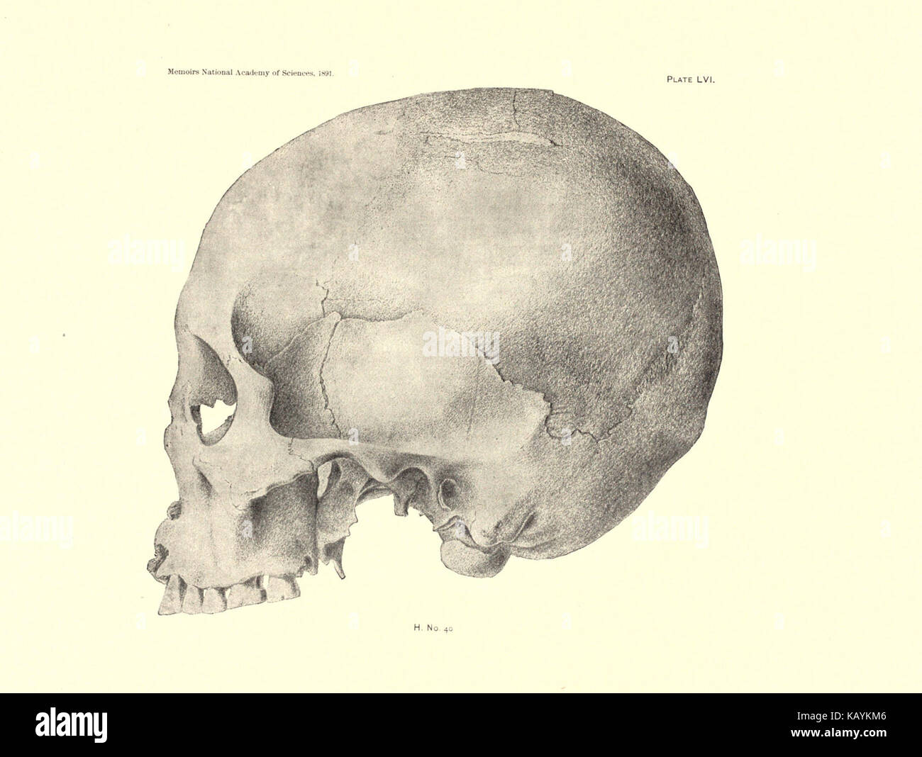The human bones of the Hemenway collection in the United States Army ...