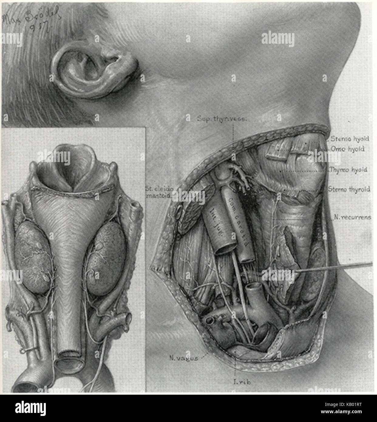 Thyroid surgery anatomy hi-res stock photography and images - Alamy