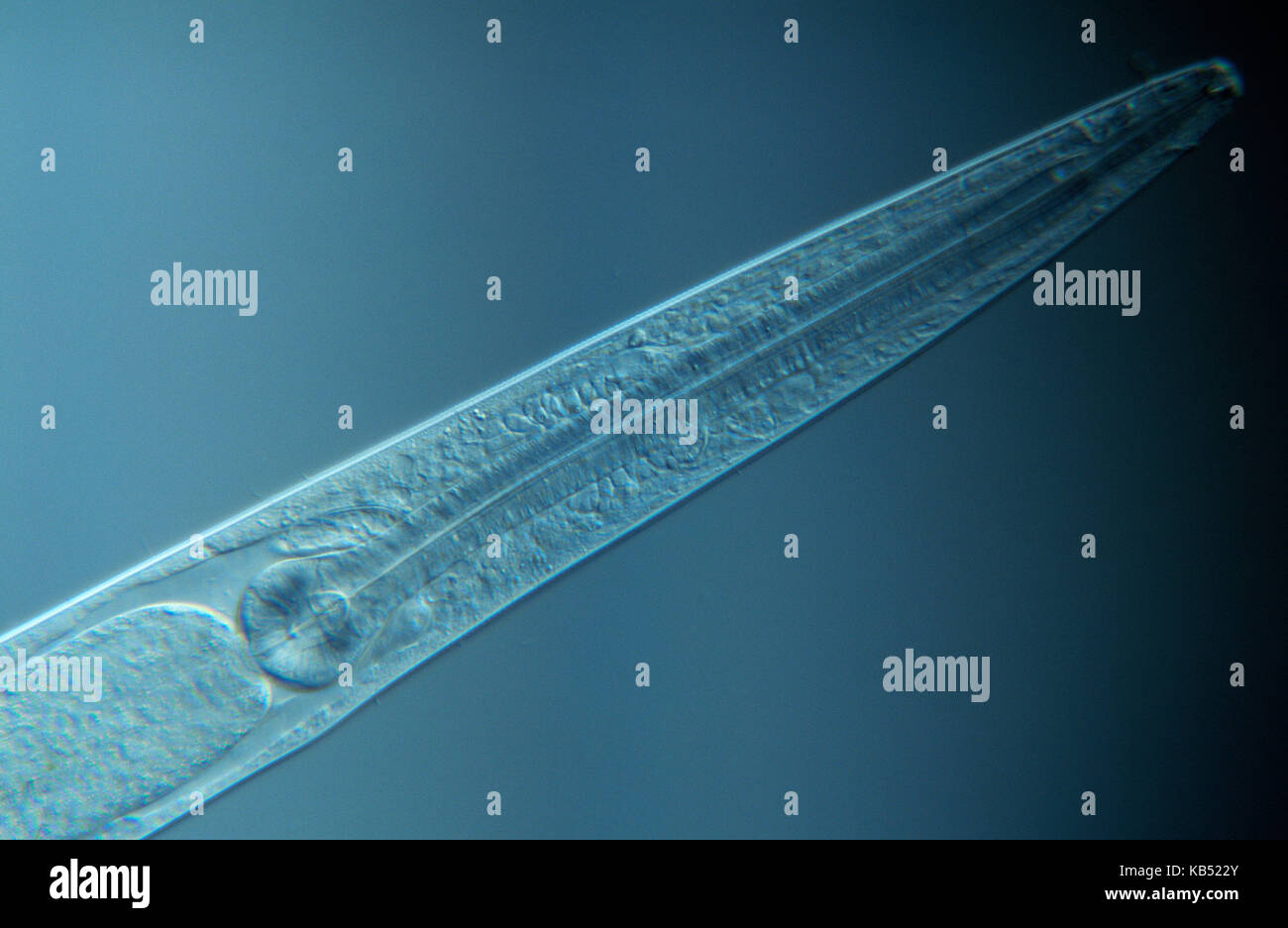 Roundworm hi-res stock photography and images - Alamy