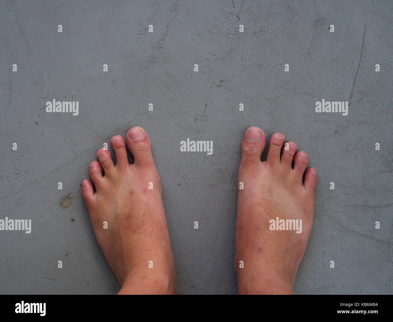 Barefoot Top View. No Shoe. Left and Right Side. a Thai Chinese Man ...