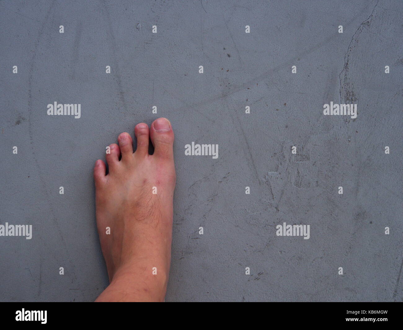 Barefoot Top View. No Shoe. Left and Right Side. a Thai Chinese Man ...