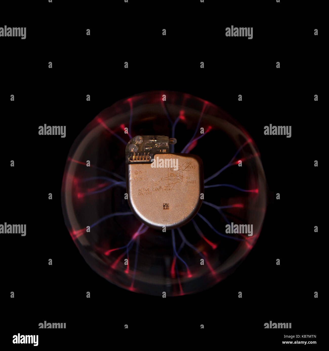 Implantable cardioverter-defibrillator pacemaker Stock Photo - Alamy