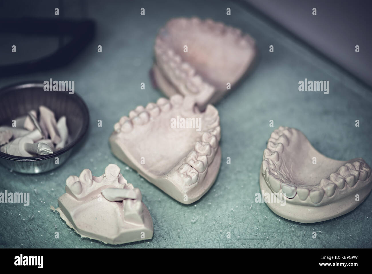 Dental prosthesis, artificial tooth. Photo of artificial teeth made in ...