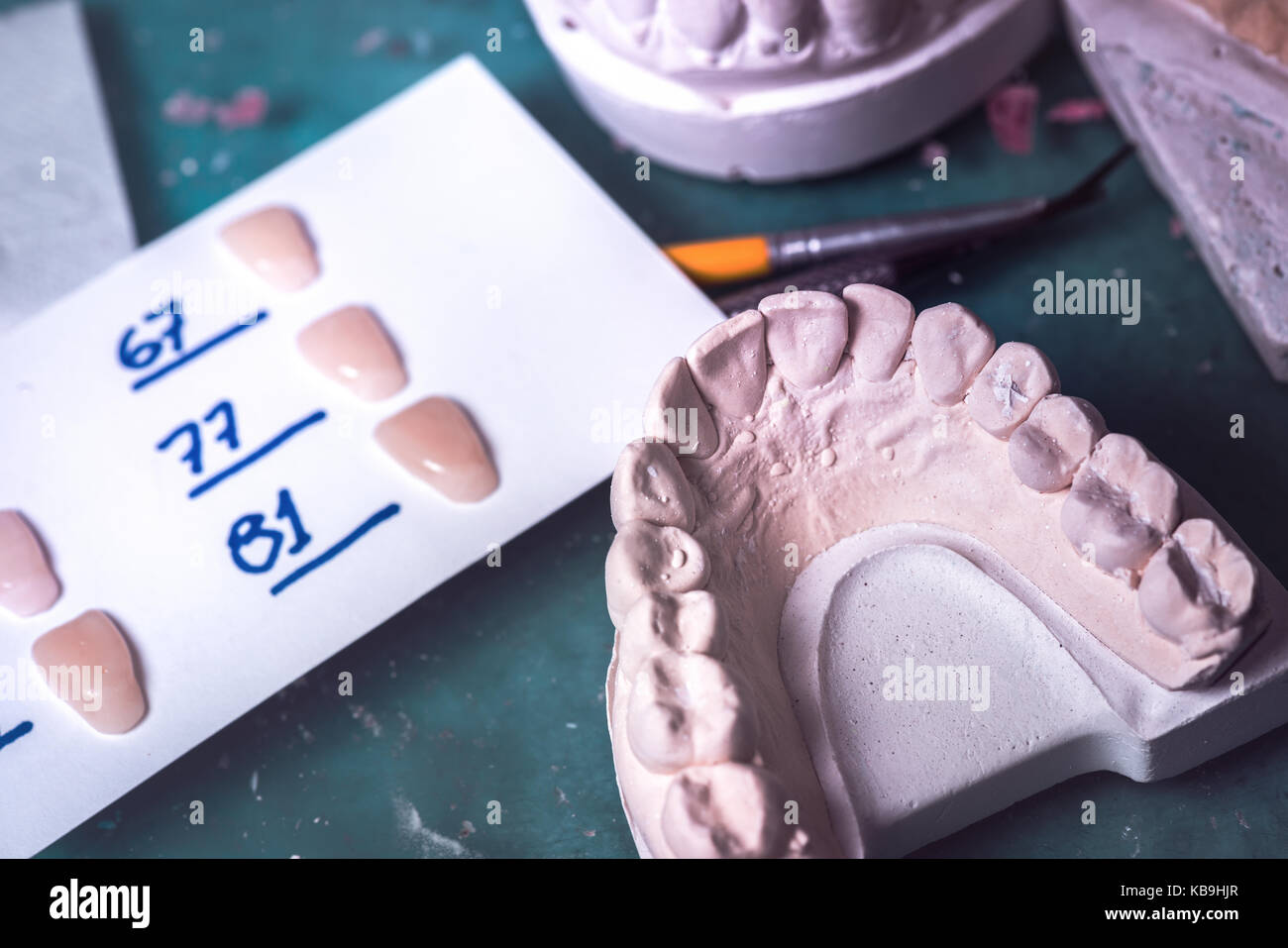 Dental prosthesis, artificial tooth. Photo of artificial teeth made in ...