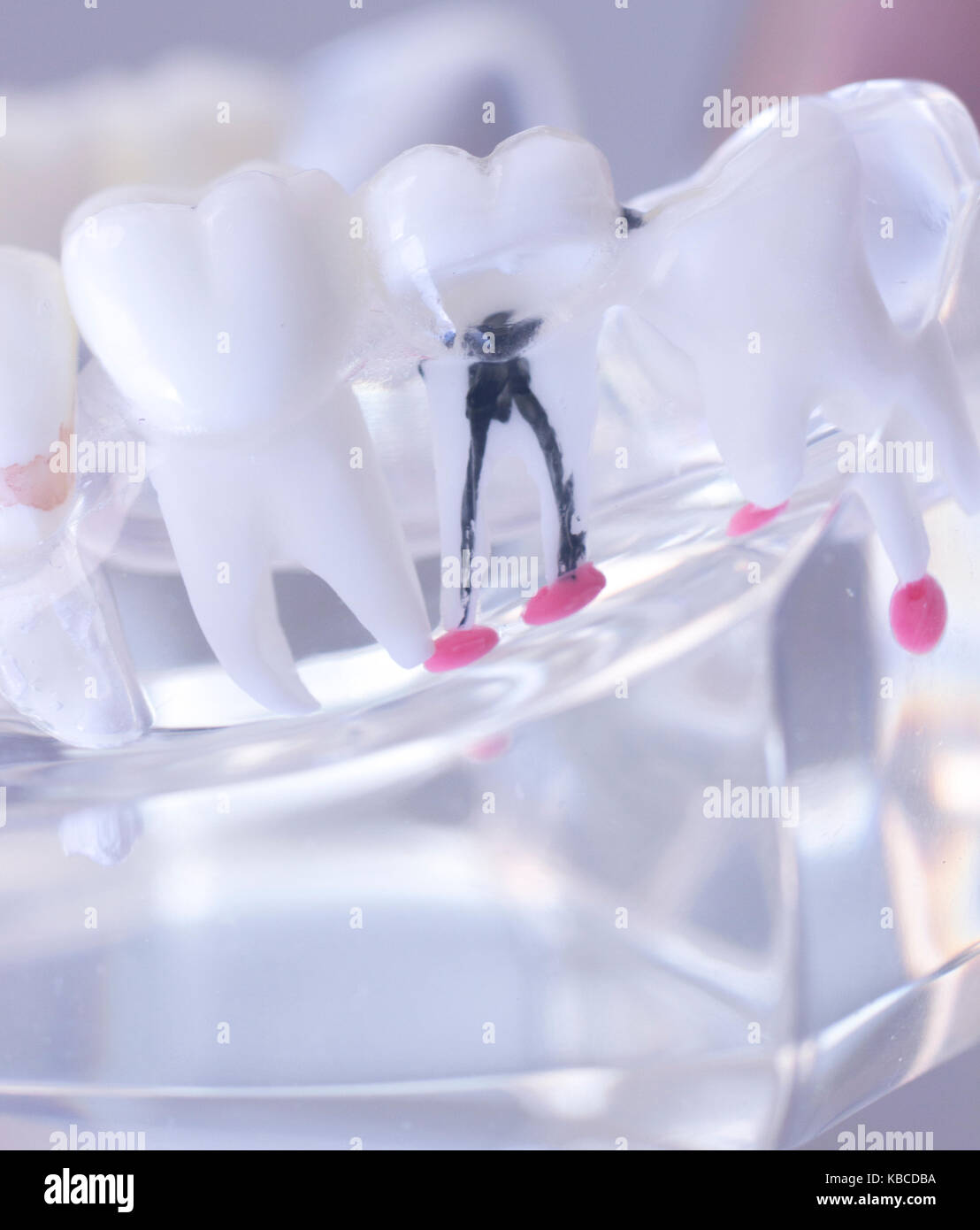 Dental teeth mouth dentists teaching model with teeth, gums, molars and ...