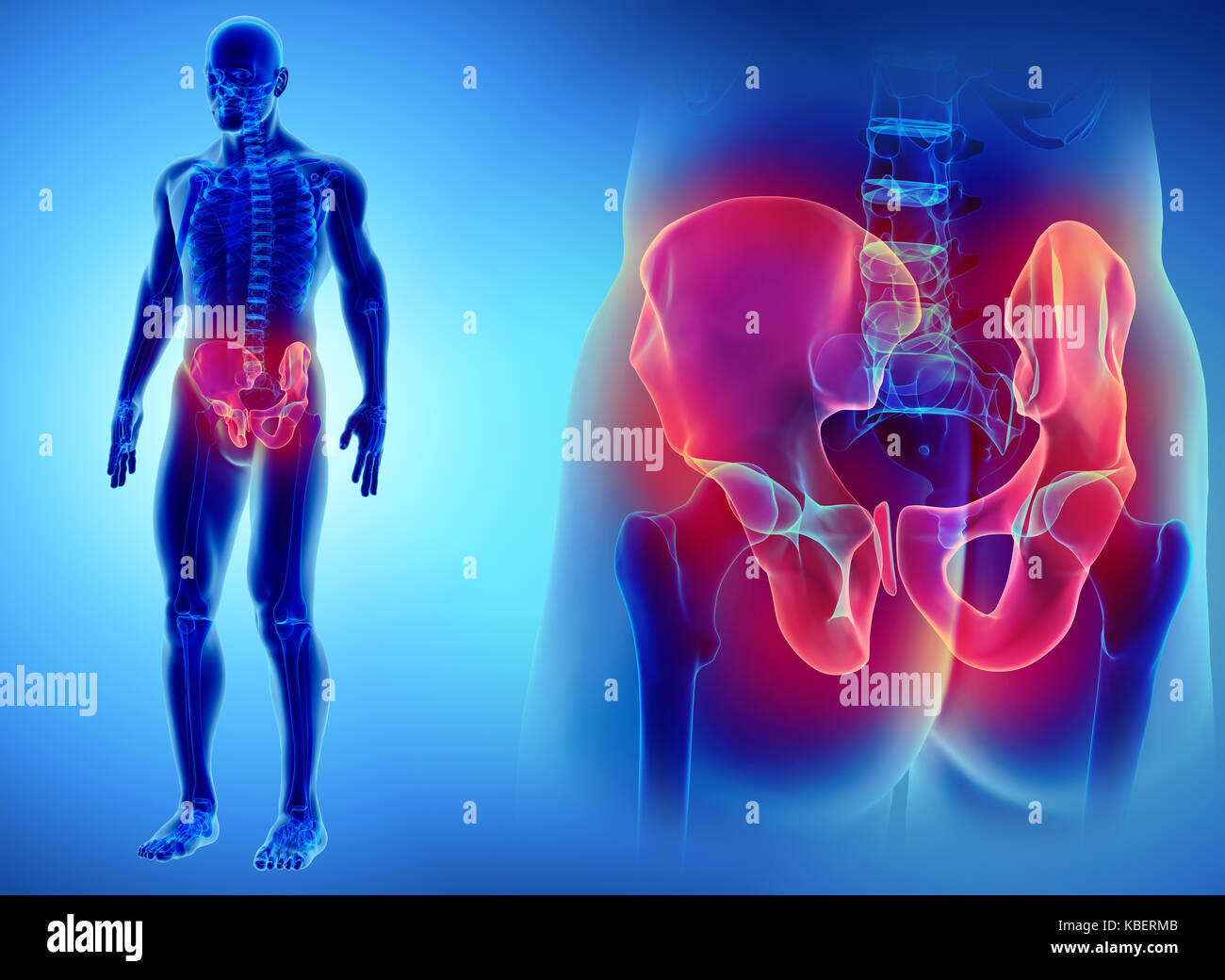 Broken hip bone xray hi-res stock photography and images - Alamy