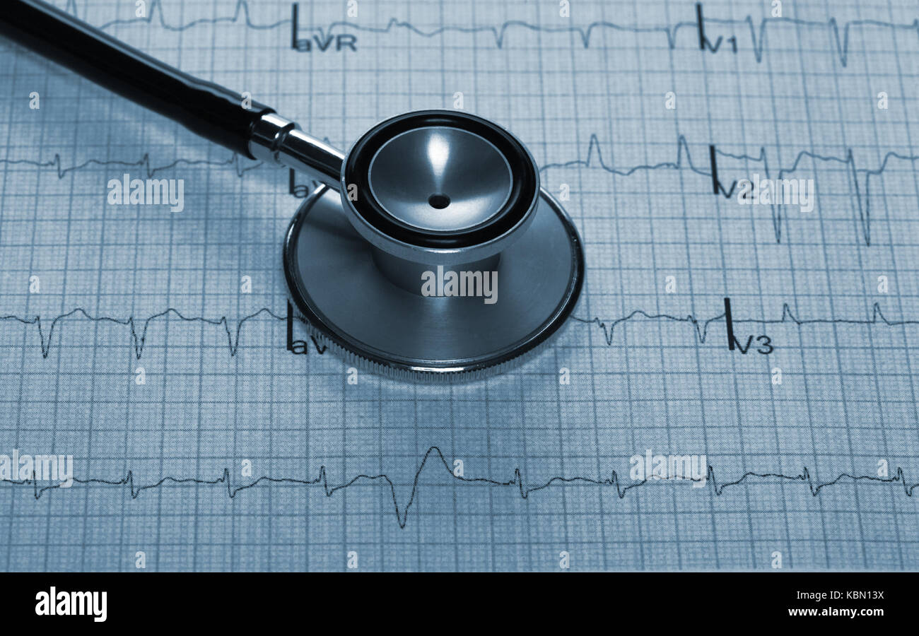 Close up view of a stethoscope on electrocardiogram background. Tinted ...