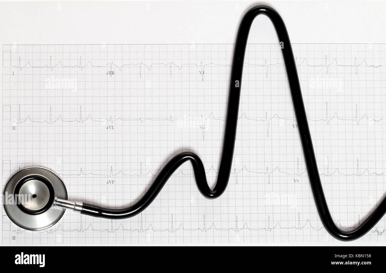 Stethoscope in the shape of heart beat on electrocardiogram Stock Photo ...
