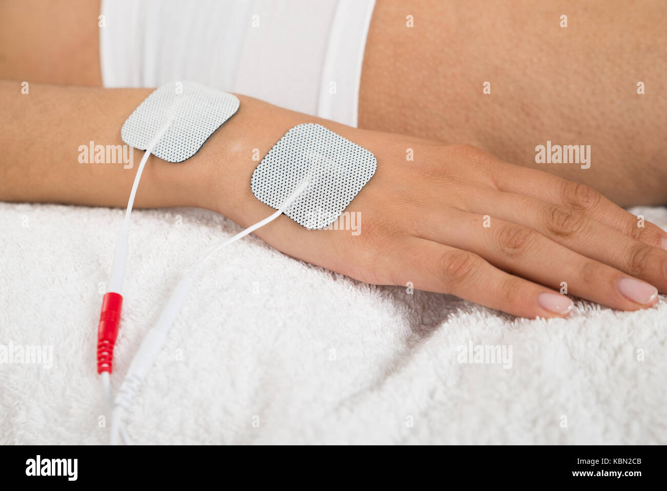 Close-up Of A Woman With Electrodes On Her Hand Stock Photo - Alamy