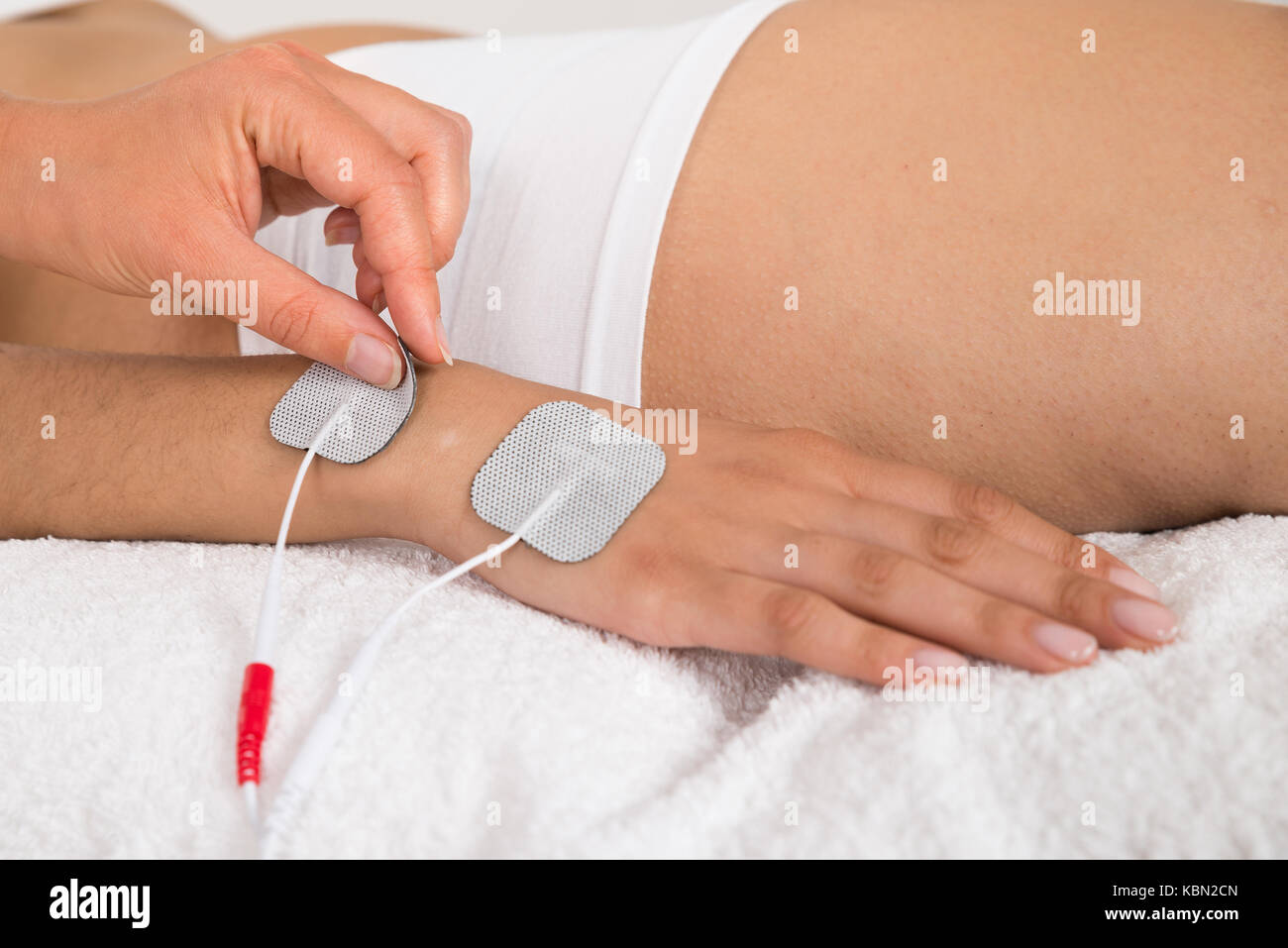 Close-up Of Therapist Placing Electrodes On Woman's Hand Stock Photo ...
