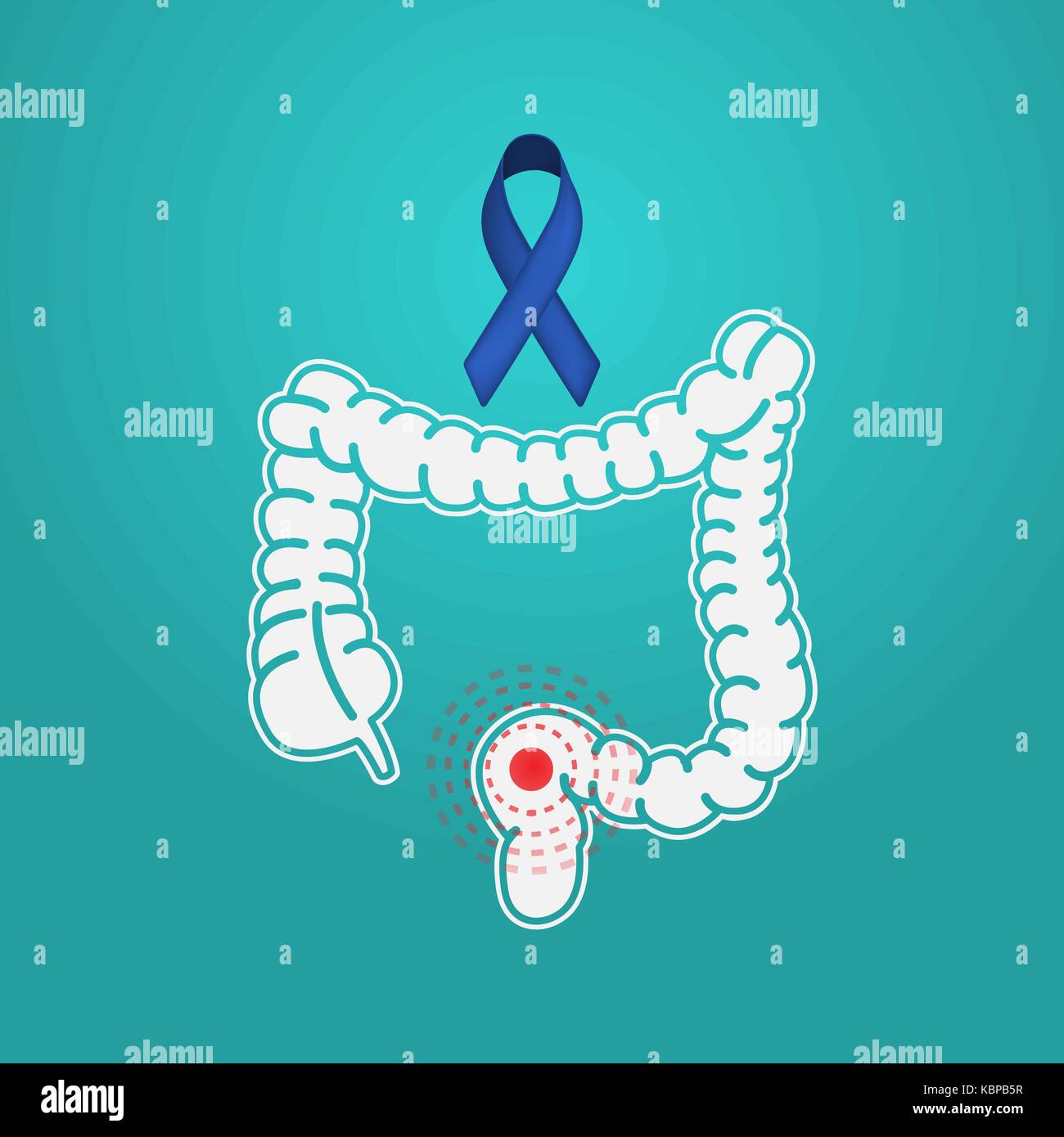 Colon Cancer vector logo icon illustration Stock Vector Image & Art - Alamy