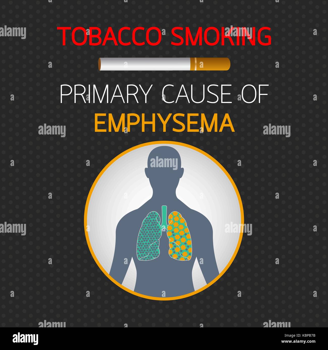 EMPHYSEMA vector logo icon illustration Stock Vector Image & Art - Alamy