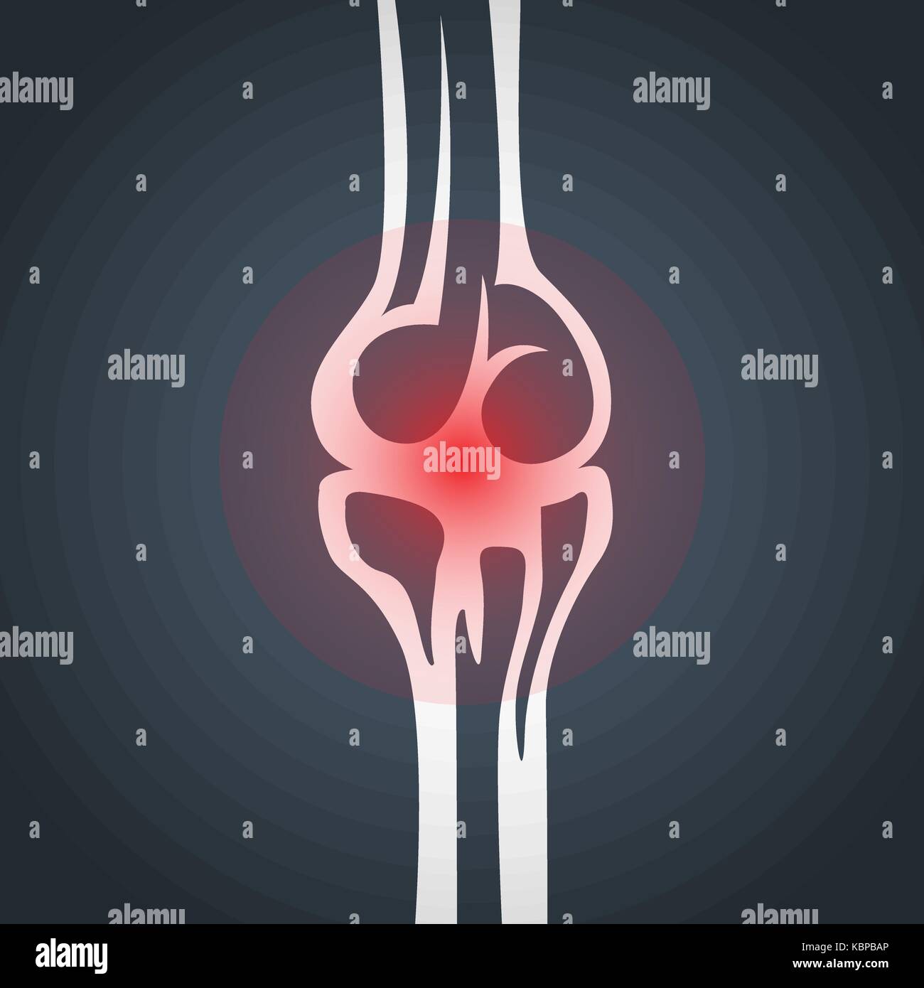 JOINT PAIN vector icon illustration Stock Vector Image & Art - Alamy