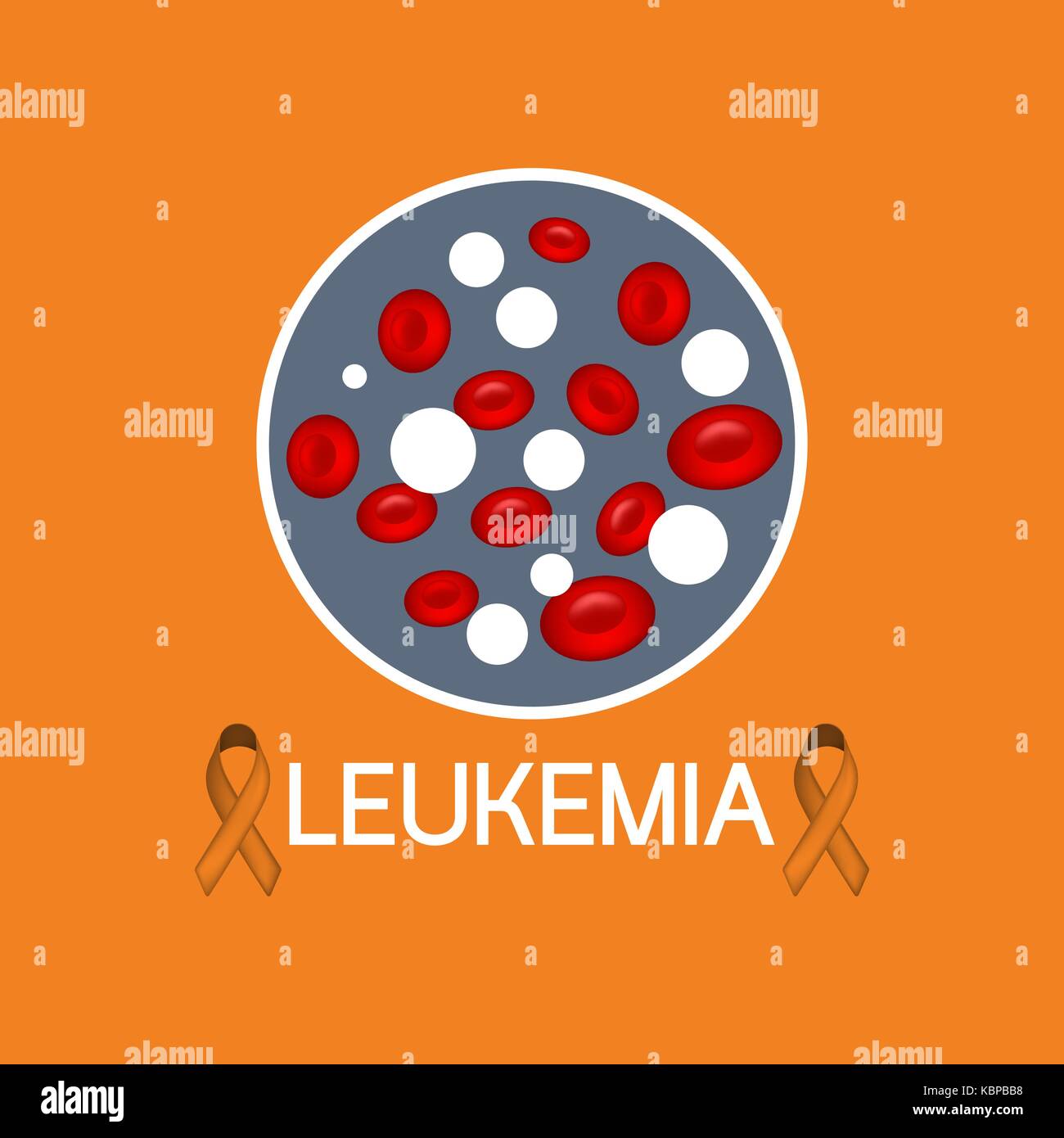 Leukemia lymphoma hi-res stock photography and images - Alamy