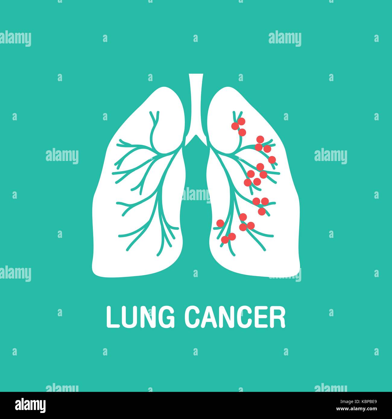 Lung cancer Stock Vector Images - Alamy
