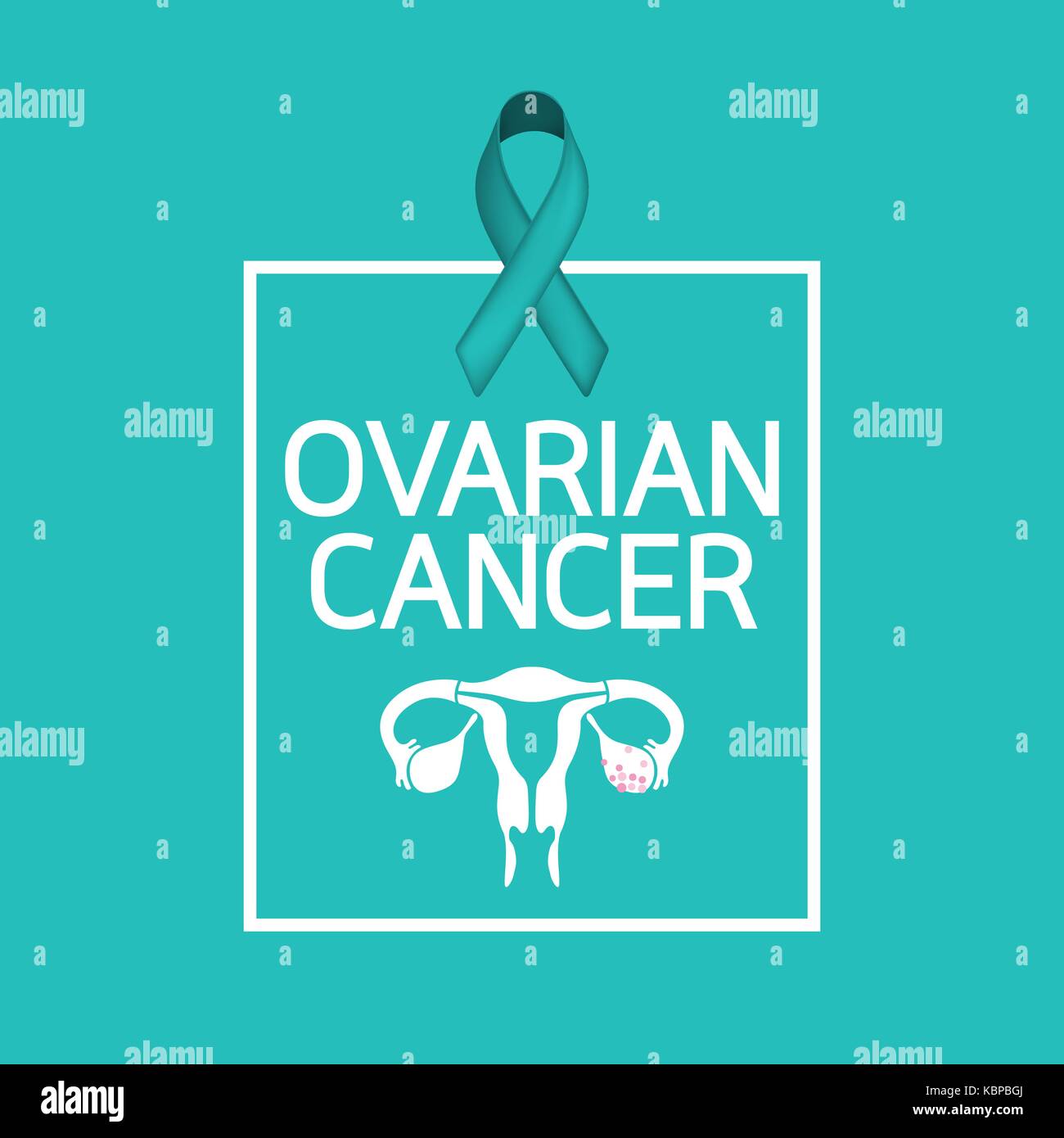 Ovarian cancer Stock Vector Images - Alamy