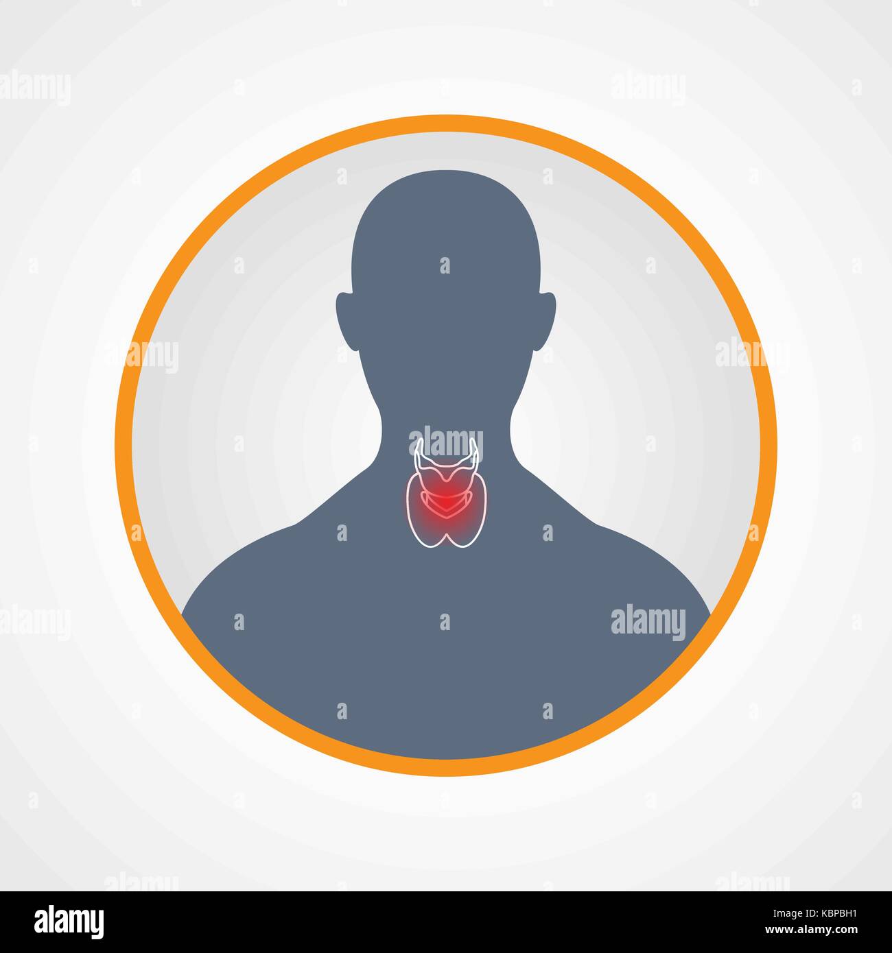 Hyperthyroidism Stock Photos & Hyperthyroidism Stock Images - Alamy