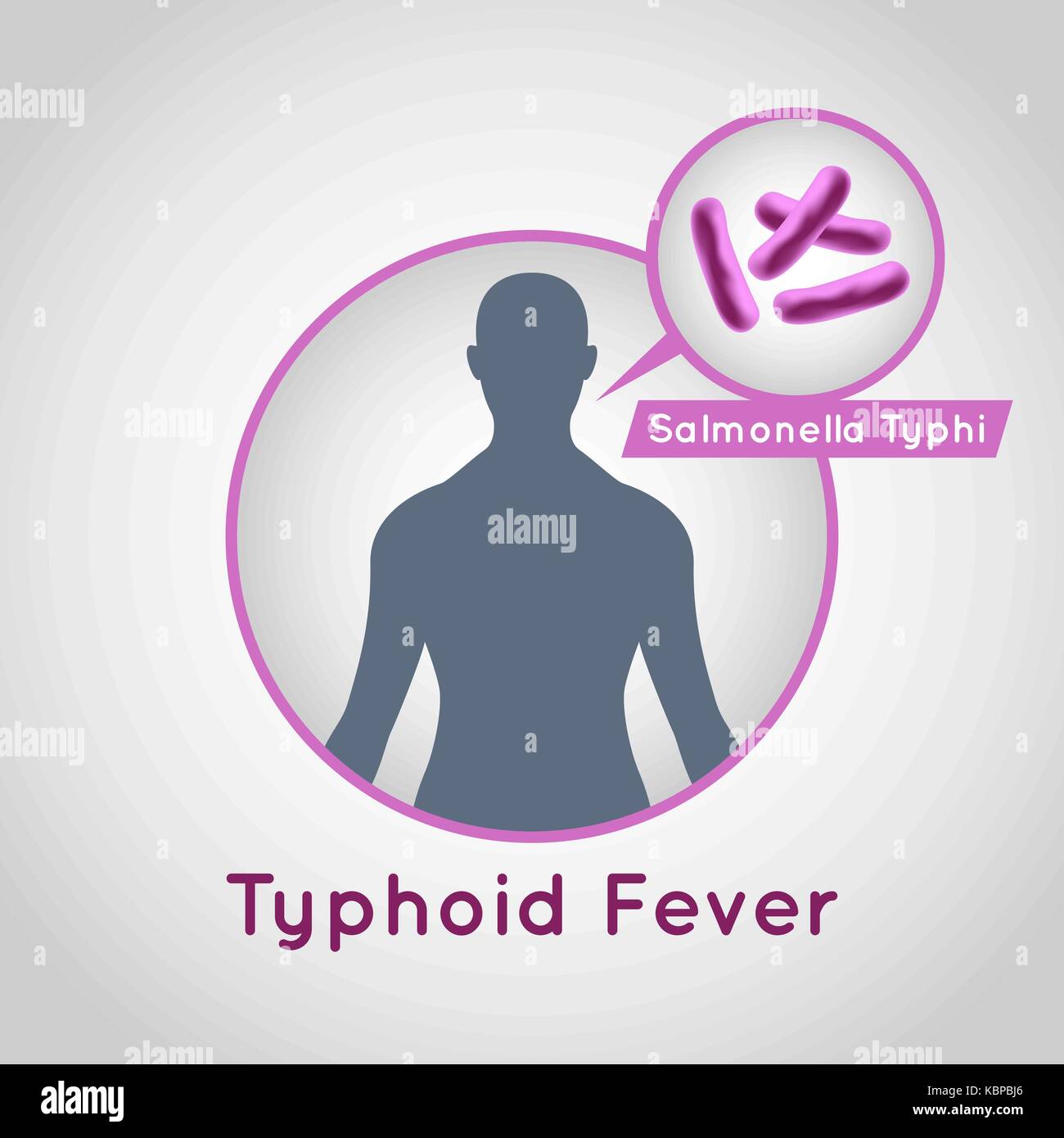 Typhoid disease Stock Vector Images - Alamy