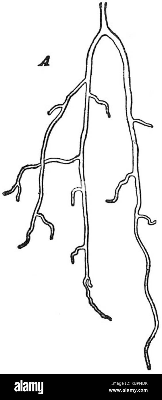 EB1911 Plants portion of laticiferous coenocyte from a Euphorbia leaf ...