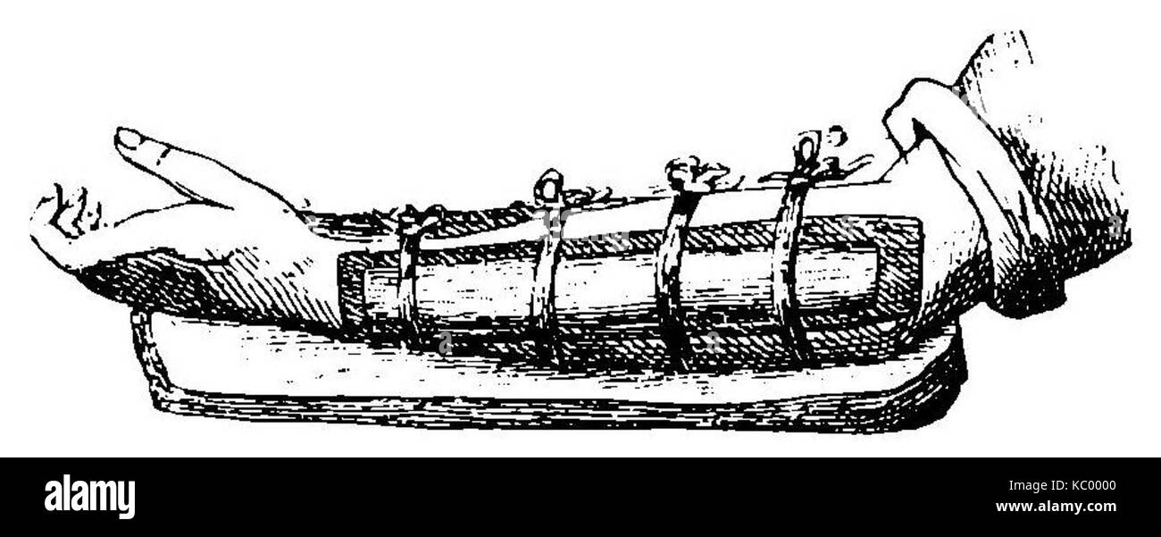 Muscle arm anatomy drawing hi-res stock photography and images - Alamy