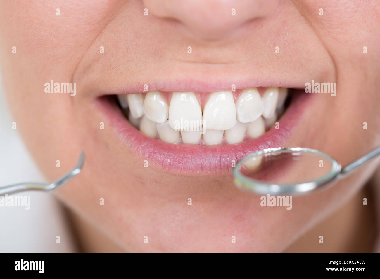 Close-up Of A Woman Examining Her Teeth Stock Photo - Alamy