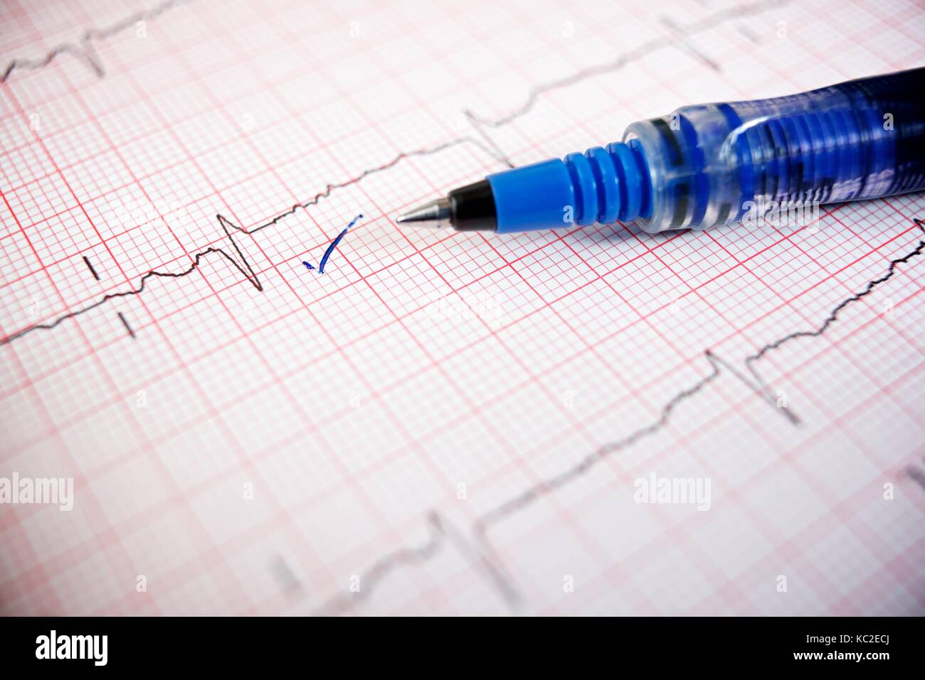 Close up of an electrocardiogram in paper form Stock Photo - Alamy