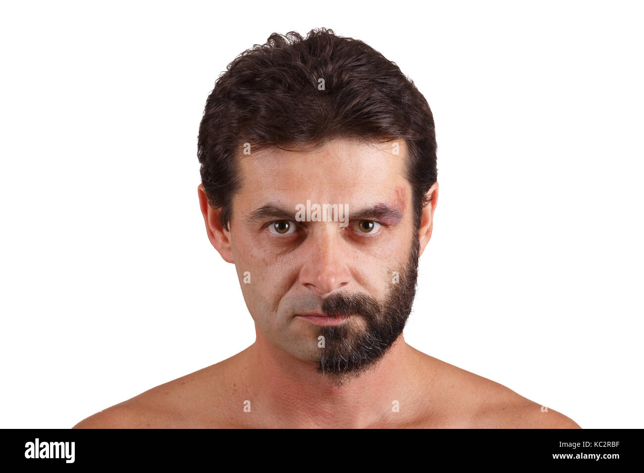 Body transformation before hi-res stock photography and images - Alamy