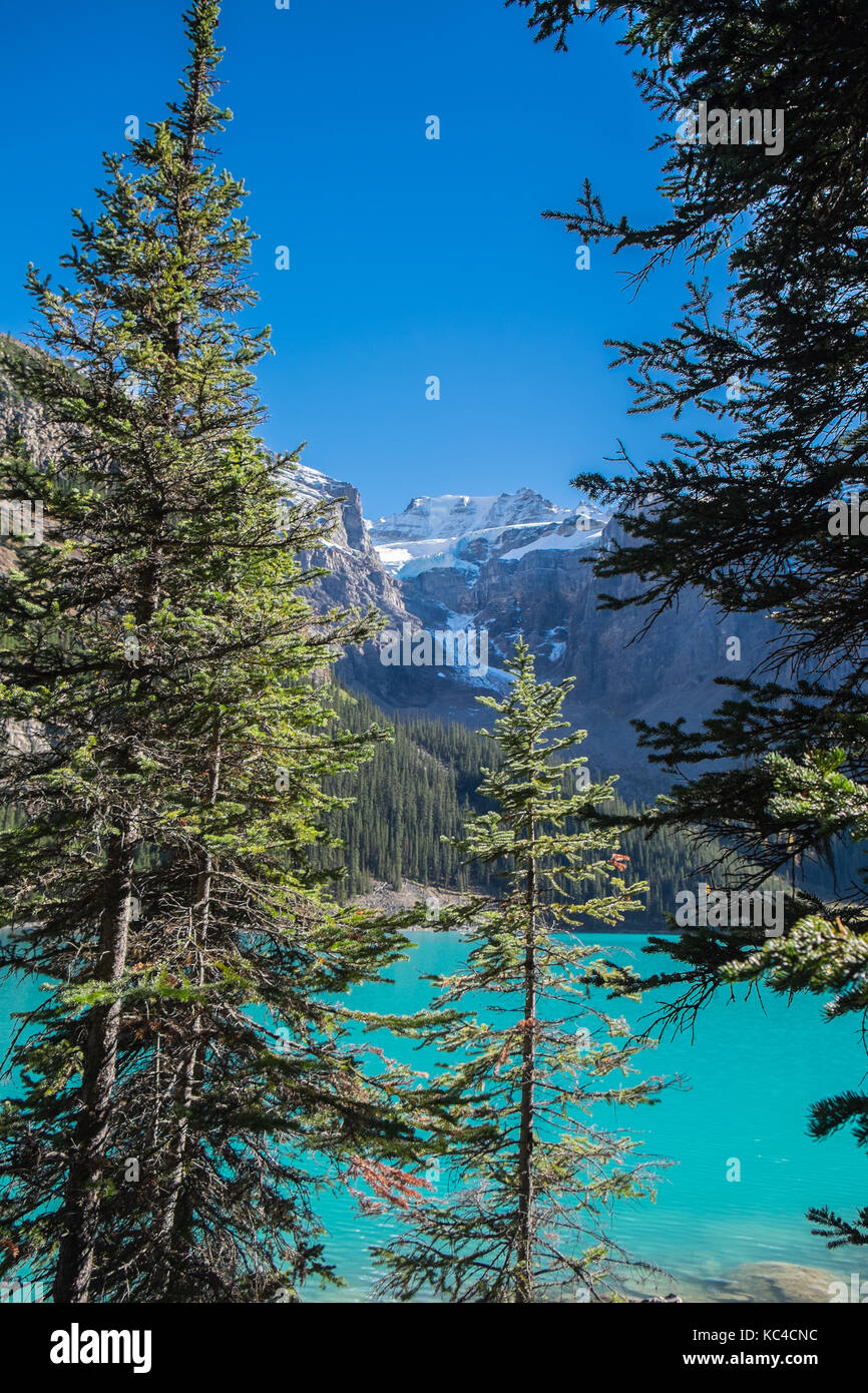 Moraine Lake Alberta Canada Stock Photo - Alamy