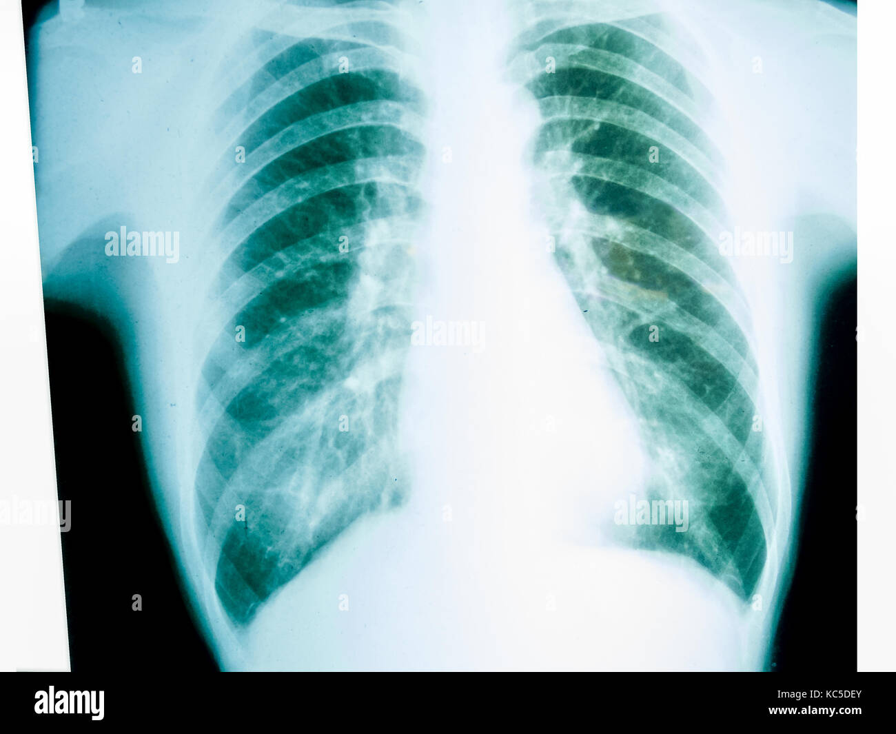 X ray anatomy hi-res stock photography and images - Alamy