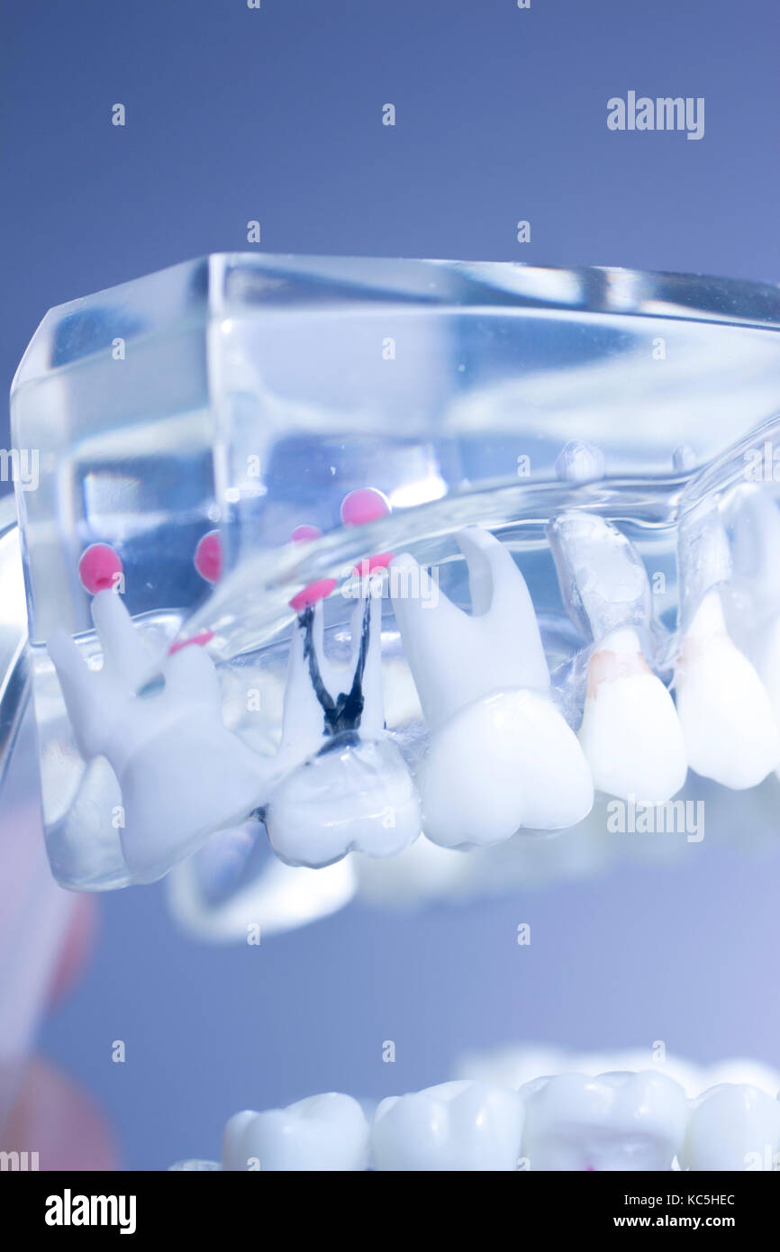 Dental teeth mouth dentists teaching model with teeth, gums, molars and ...