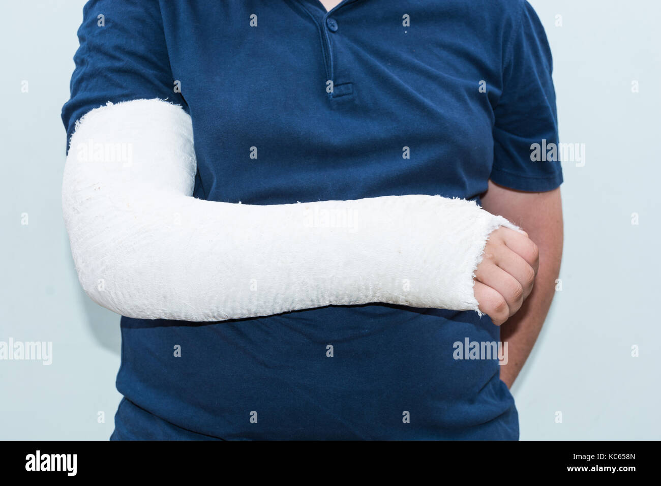 Plastering wrist hi-res stock photography and images - Alamy