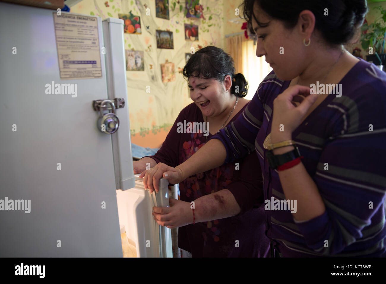 Prader willi syndrome disease hi-res stock photography and images - Alamy