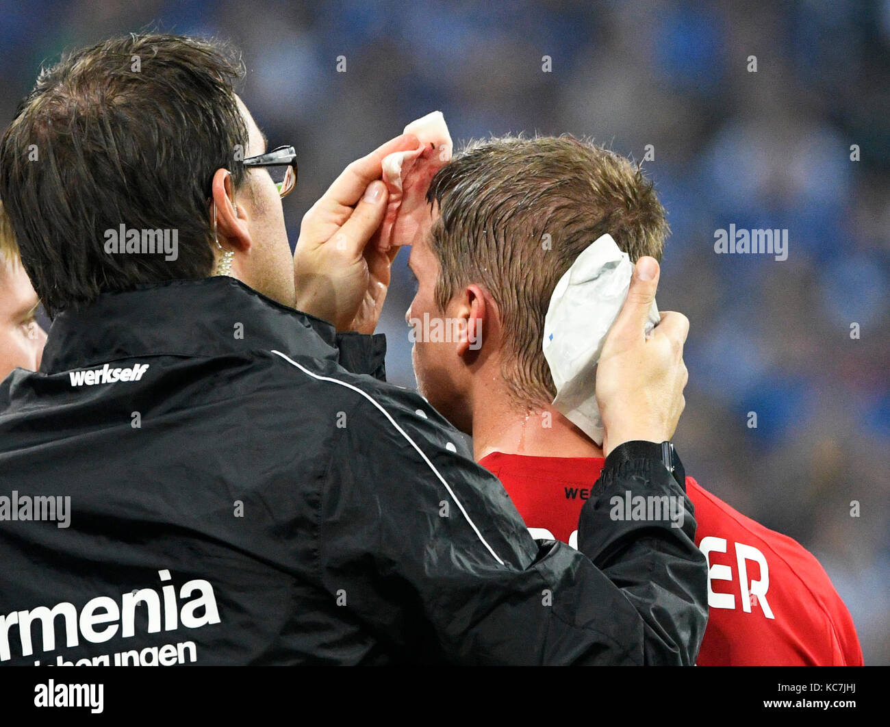 Bleeding wound head hi-res stock photography and images - Alamy